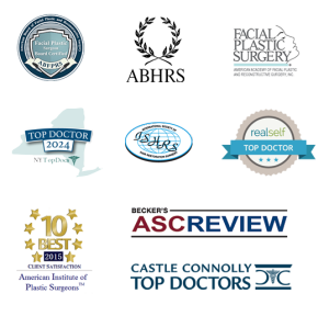 Hair Transplant Surgeon Rochester, Buffalo & Syracuse, NY – Dr. Vito C ...